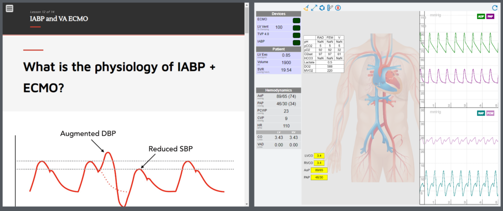 Harvi-ECMO/MCS – Harvi Academy