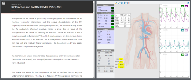 Harvi-ECMO/MCS – Harvi Academy